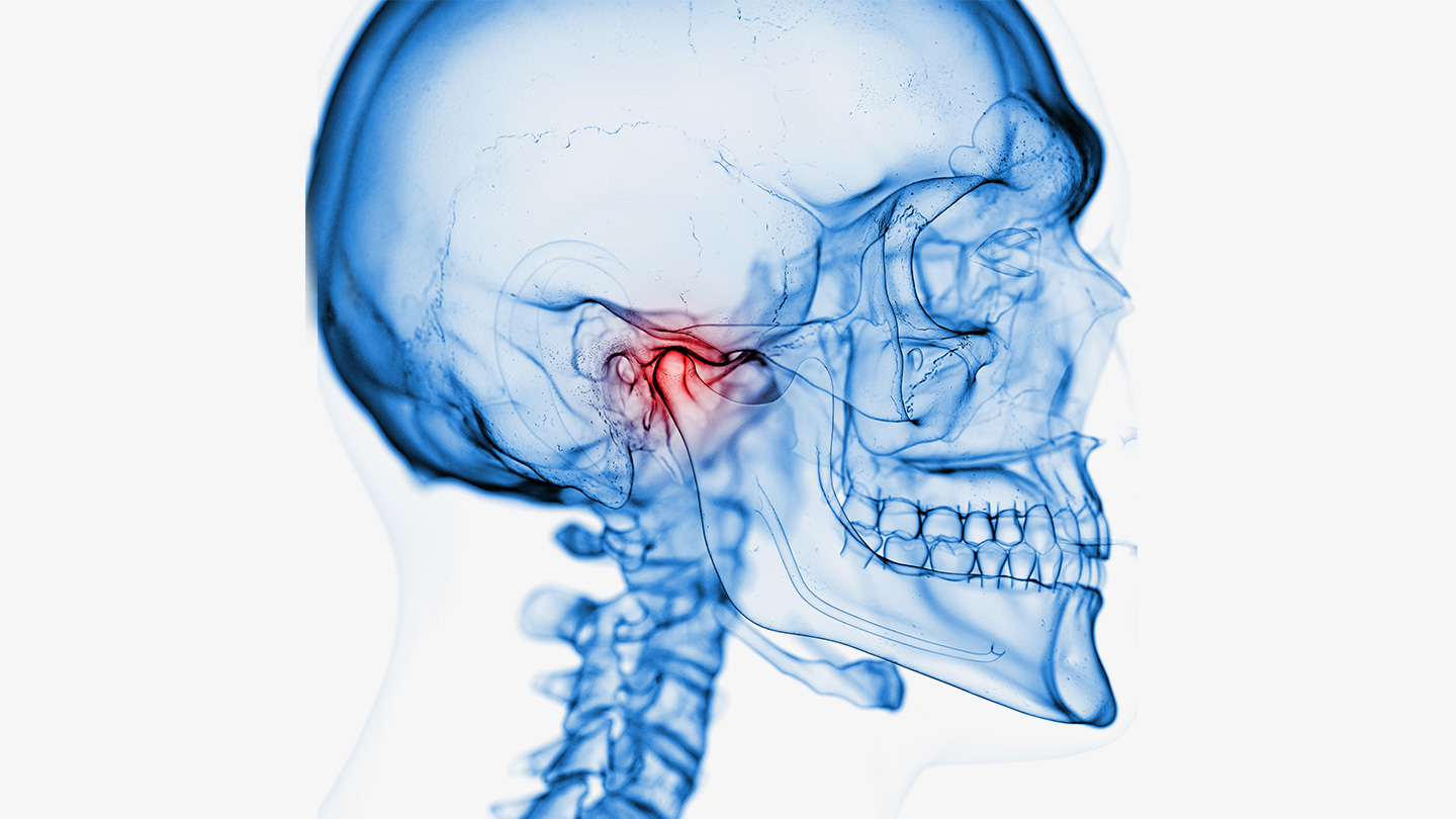 Trastornos temporomandibulares (TTM) - Clínica Visage